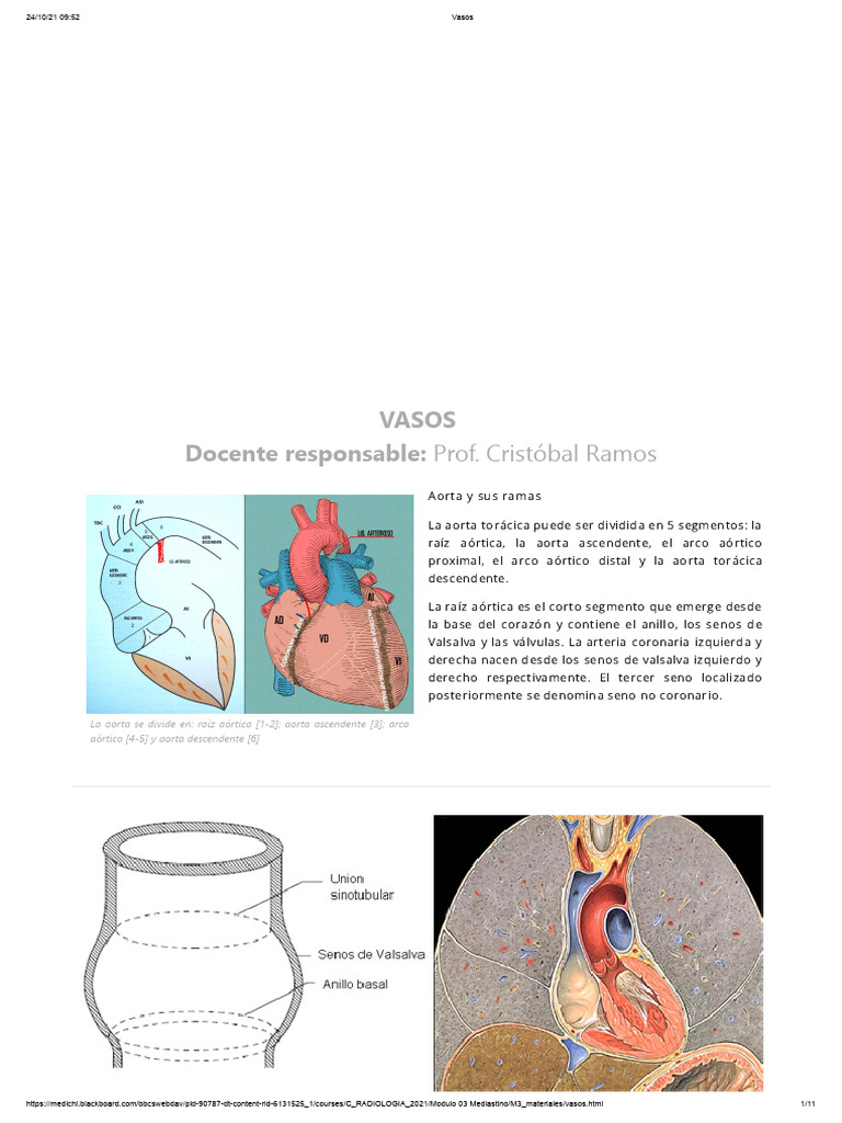 Vasos | PDF | Aorta | Tórax (anatomía humana)