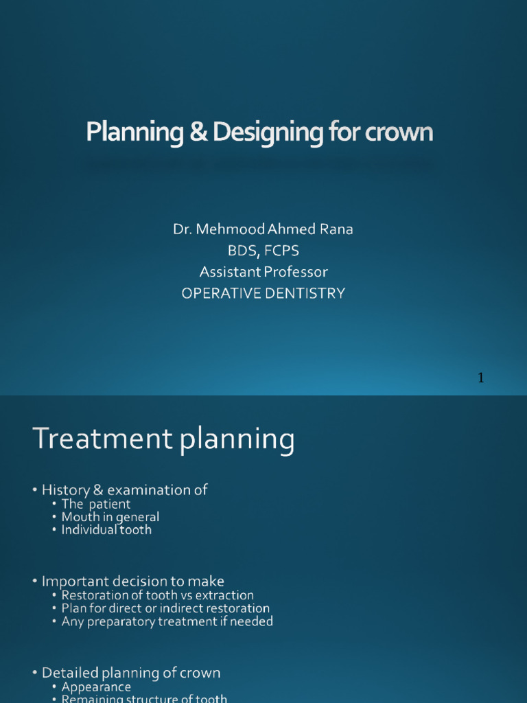 Planing For Crown | PDF