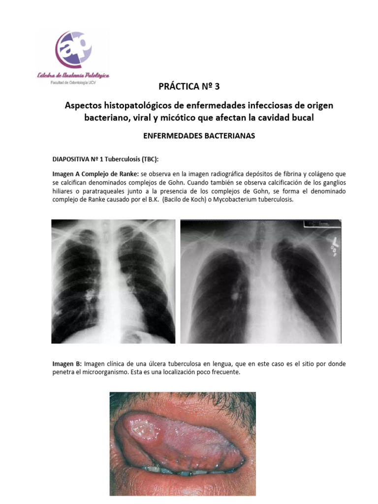 Guión Practica #3 2023 Infecciosas | PDF
