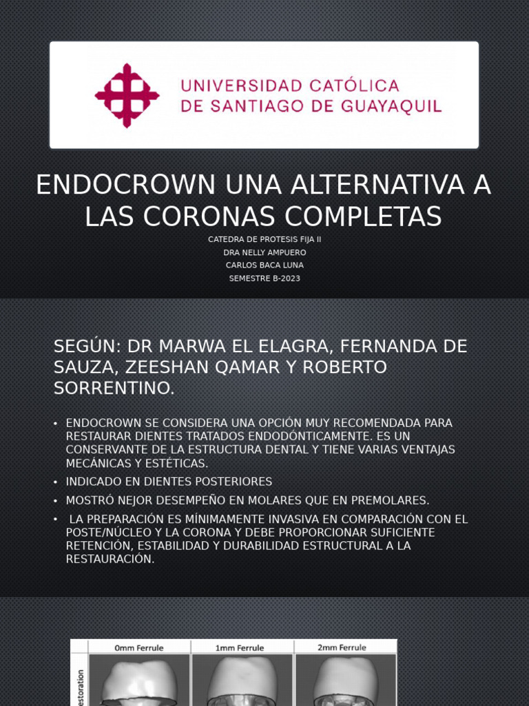 Endocrown Final | PDF