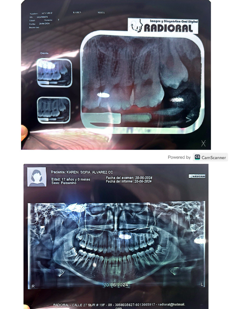 Radiografías Bichito | PDF