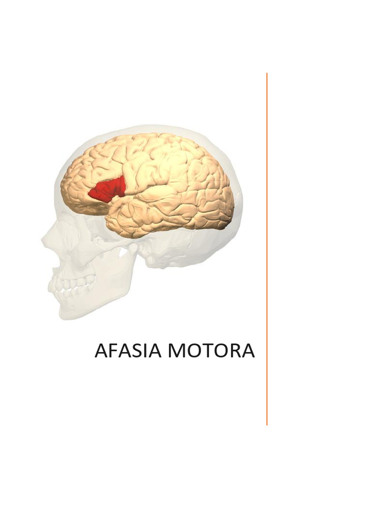 Afasia Motora | PDF