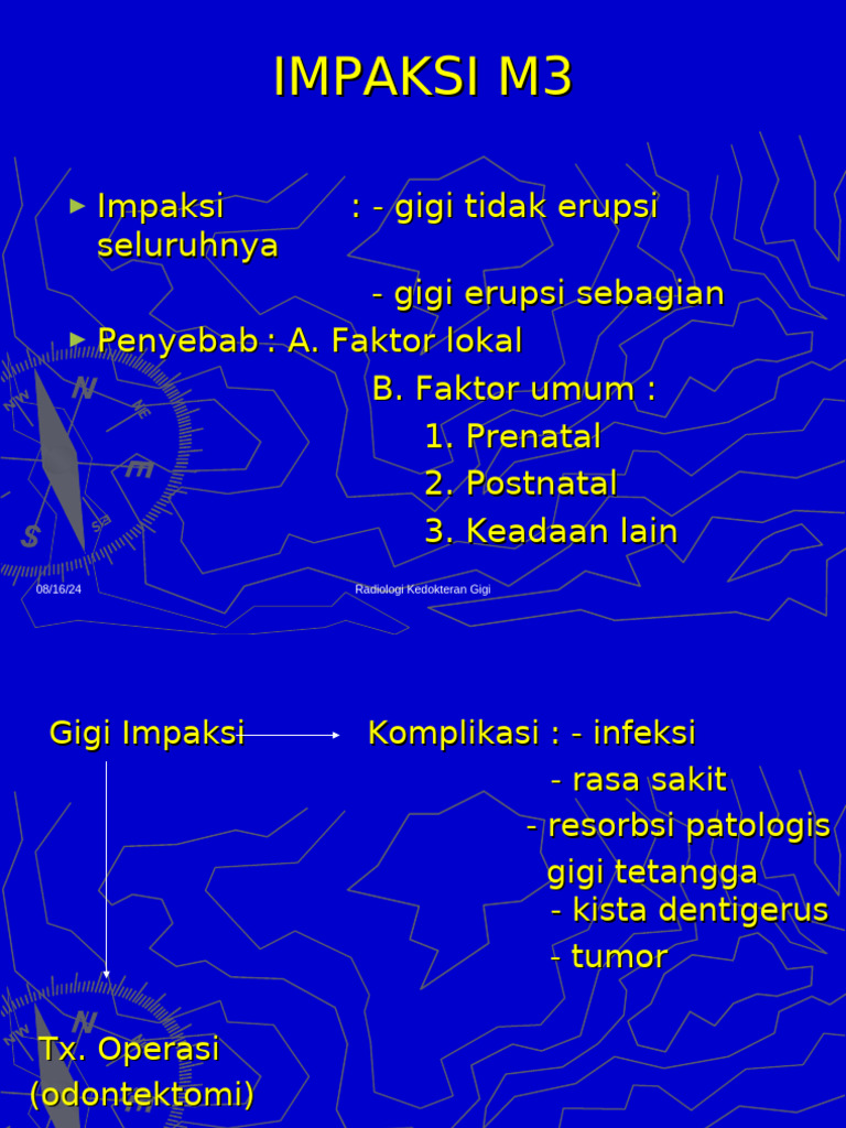 Impaksi Molar3 | PDF