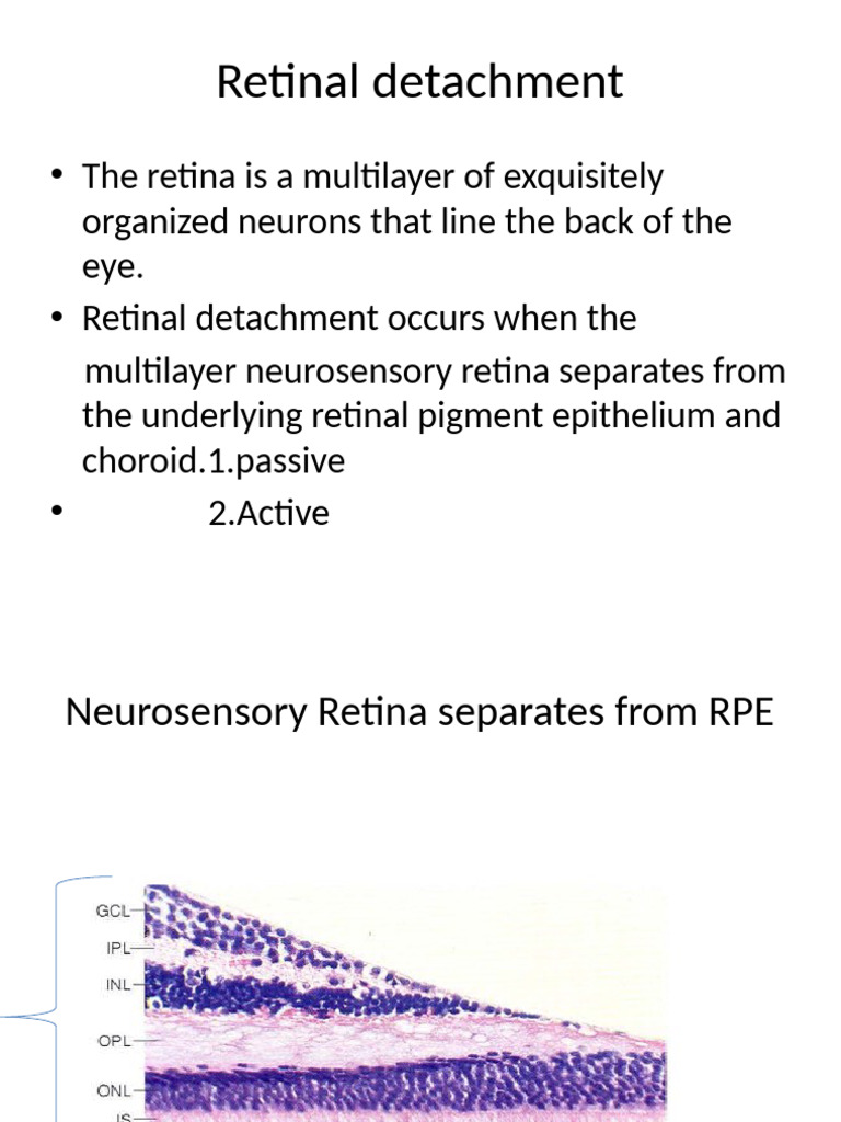 Retinal Detachment | PDF