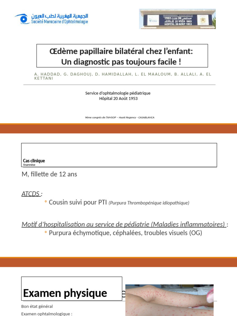 Oedeme Papillaire Bilatérale Final | PDF