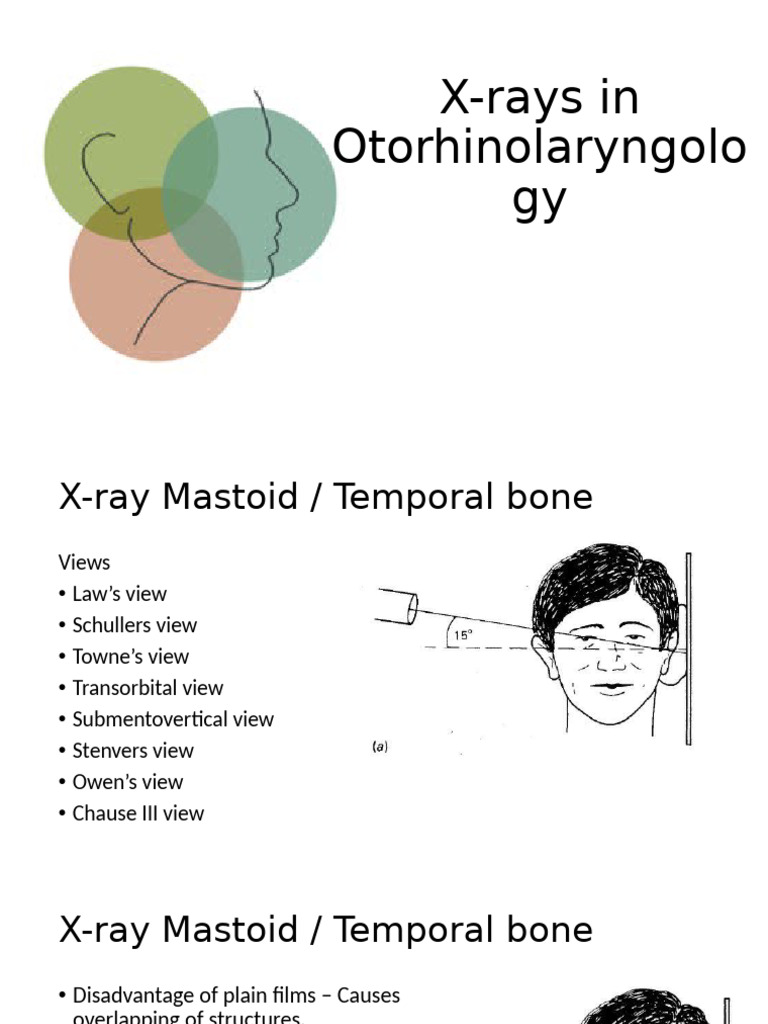 Ent Xrays | PDF
