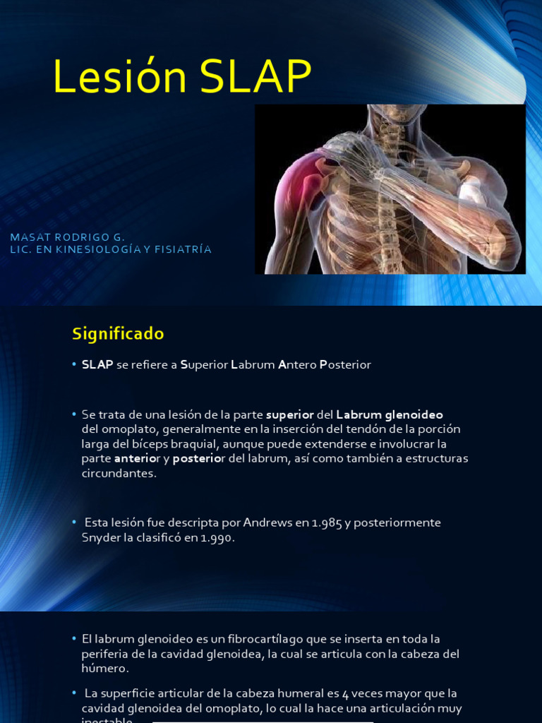 Lesión SLAP | PDF
