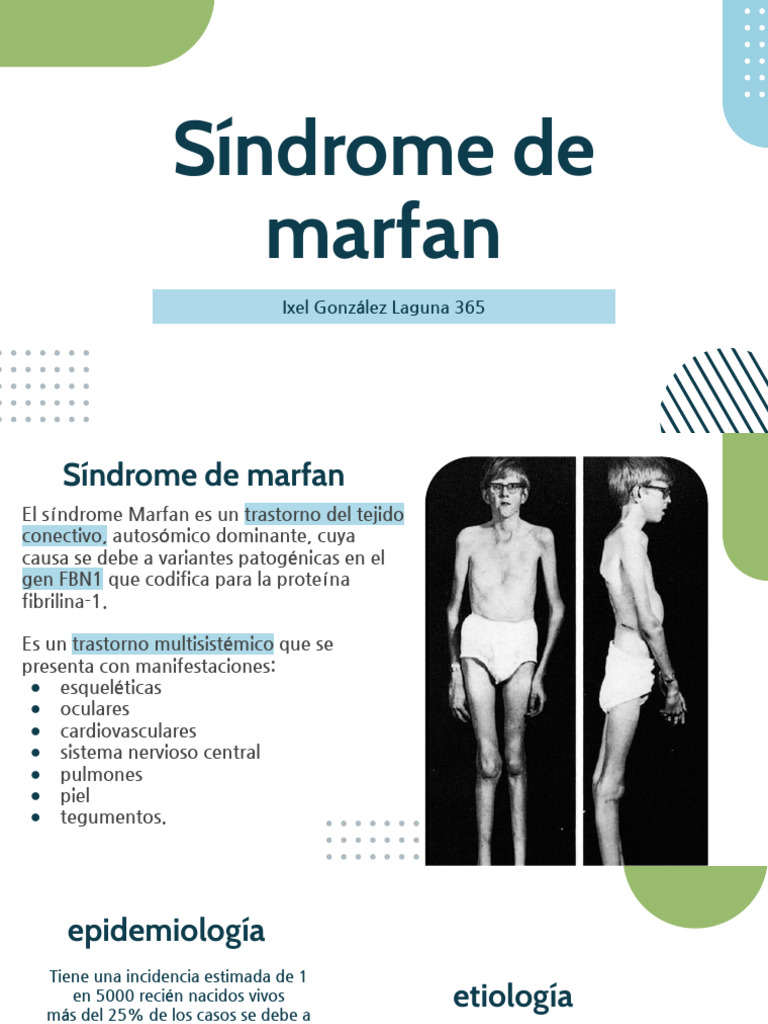 Síndrome de Marfan | PDF | Enfermedades y trastornos | Ciencia y matemáticas