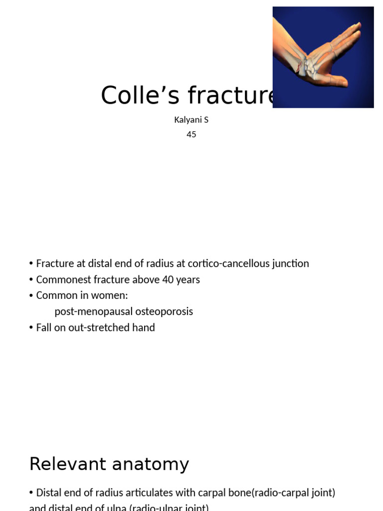Colles Fracture Ortho | PDF
