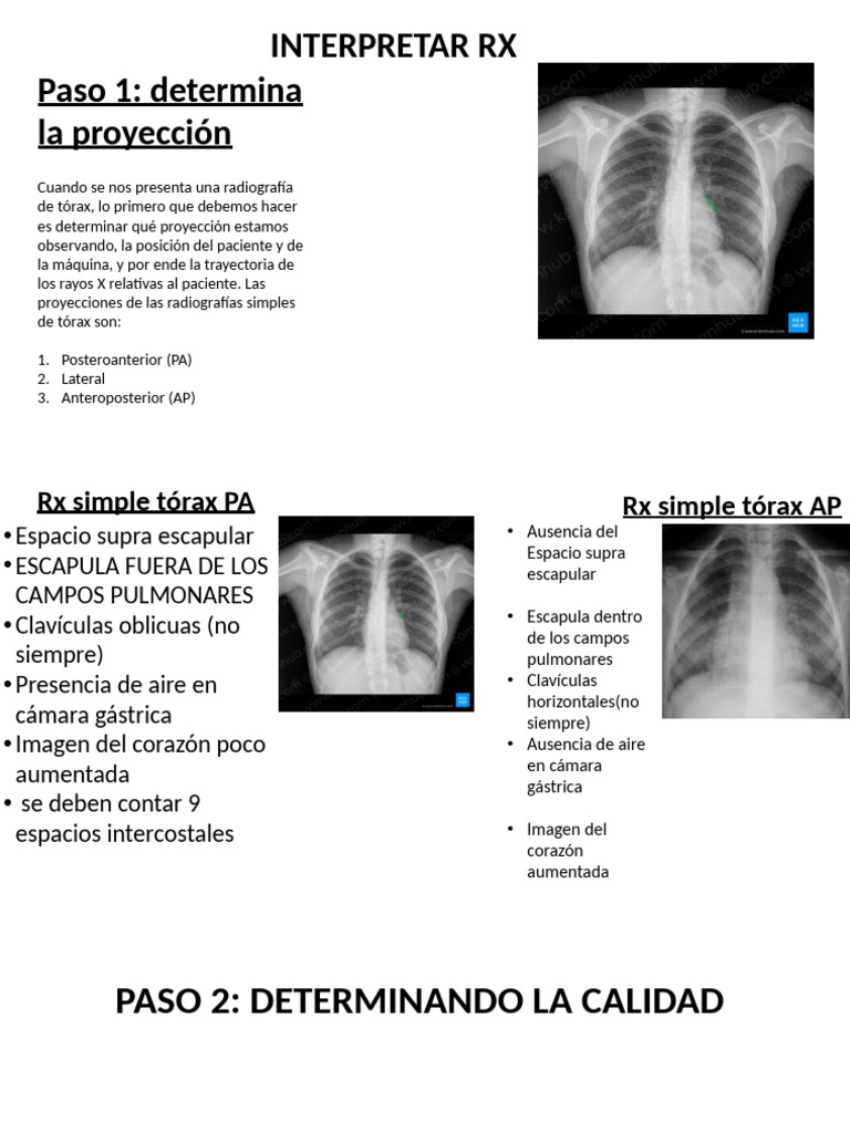 Interpretar RX de Torax | PDF