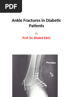 Interdigital (Morton's) Neuroma - Foot & Ankle - Orthobullets | PDF ...