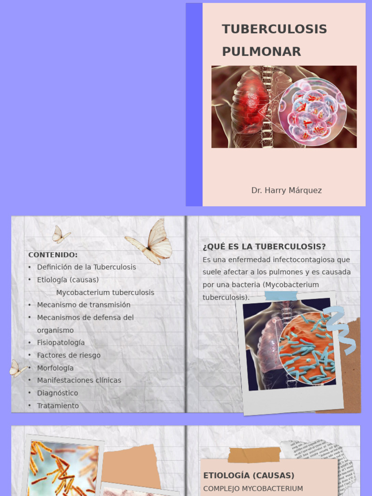 Tuberculosis Pulmonar | PDF