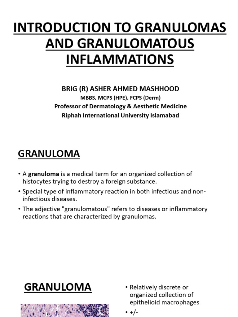 Introduction To Granulomas and Granulomatous Inflammations | PDF
