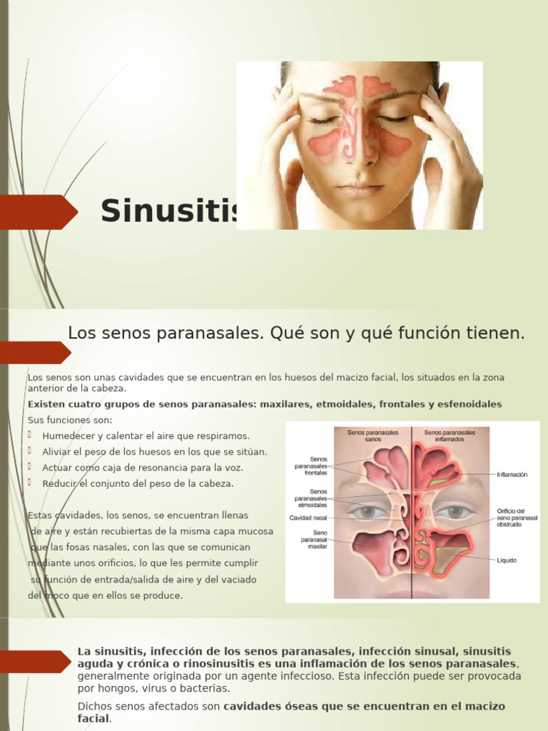 Sinusitis Aguda y Cronica | PDF | Medicina CLINICA | Estudios de idiomas extranjeros