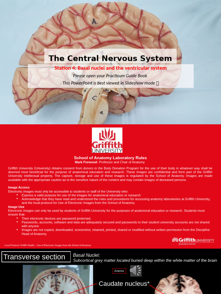 Station 4 - Basal Nuclei and Ventricles 2024 | PDF
