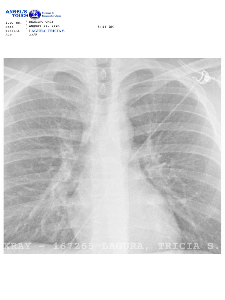 Lagura Xray, Urinalysis, CBC, Fecalysis 20240808 132819 0000 | PDF