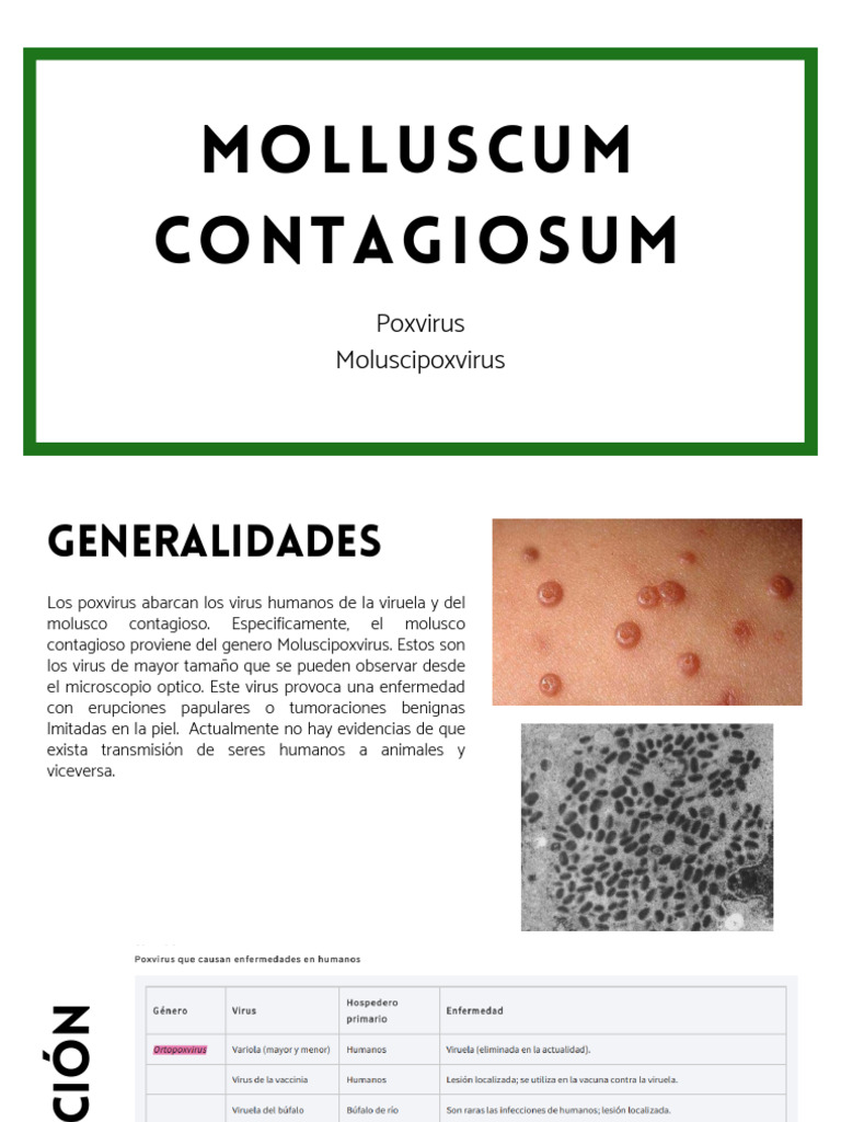 Molusco Contagioso | PDF