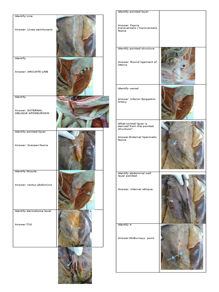 Abdominal Wall Inguinal Canal and Scrotum | PDF