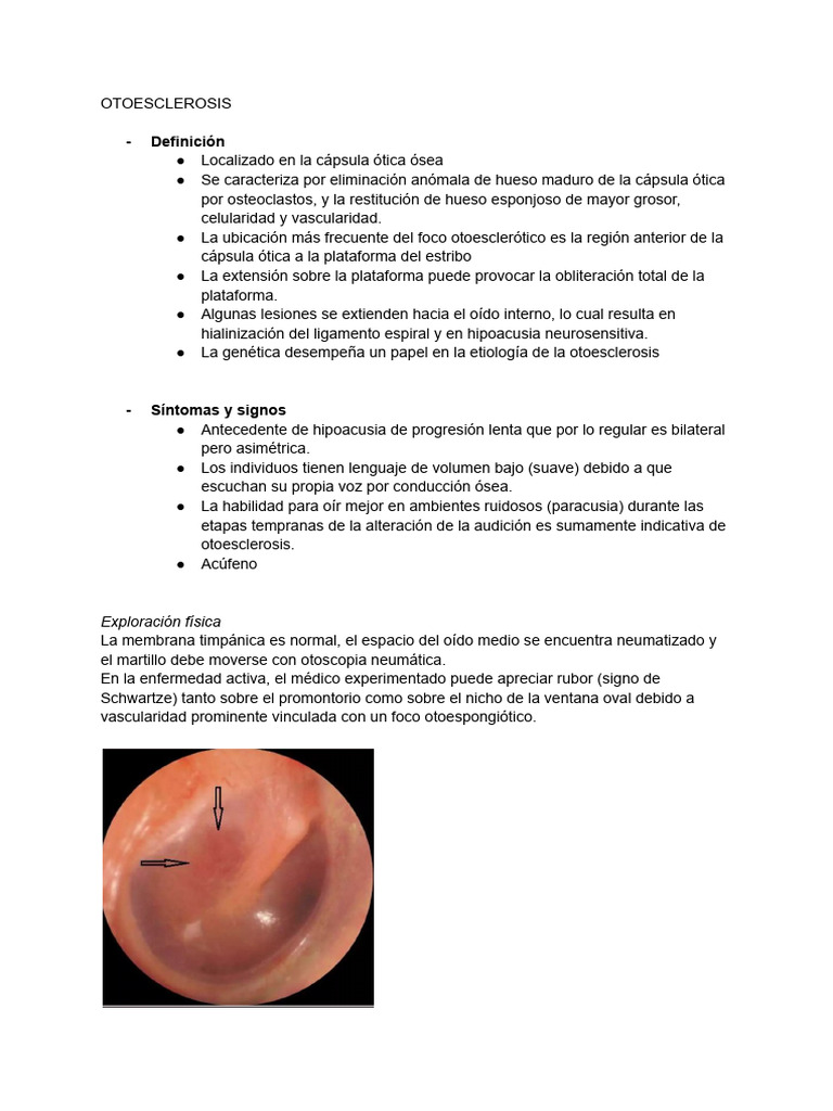 Otoesclerosis y Otitis Interna | PDF