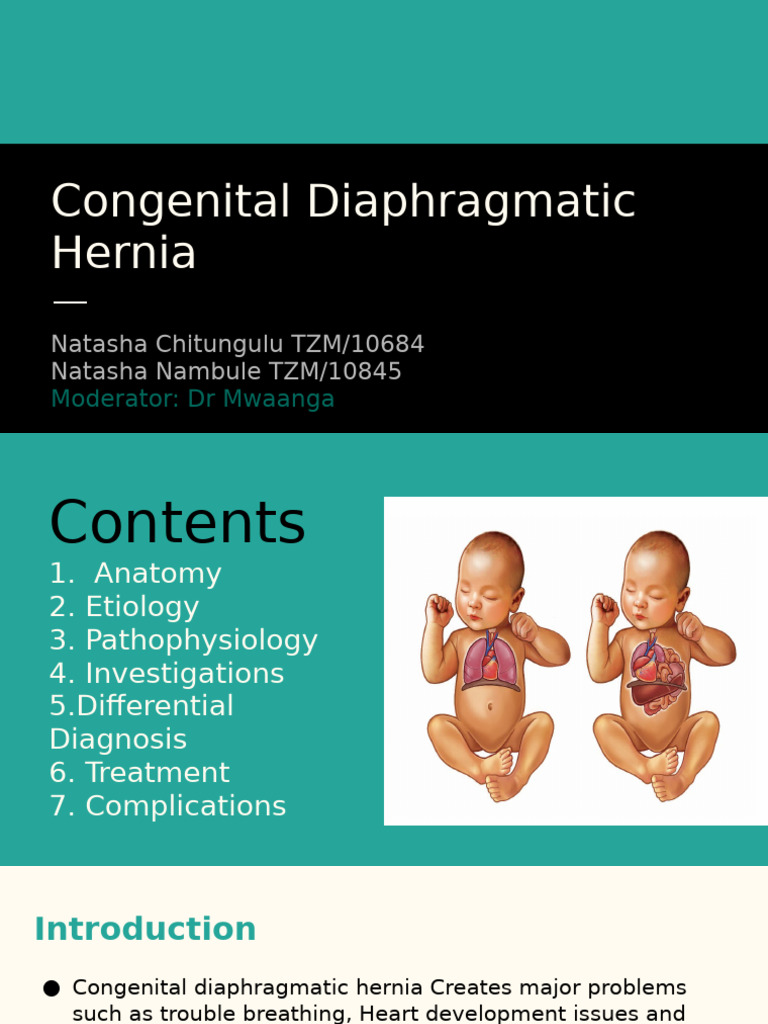 Congenital Diaphragmatic Hernia | PDF