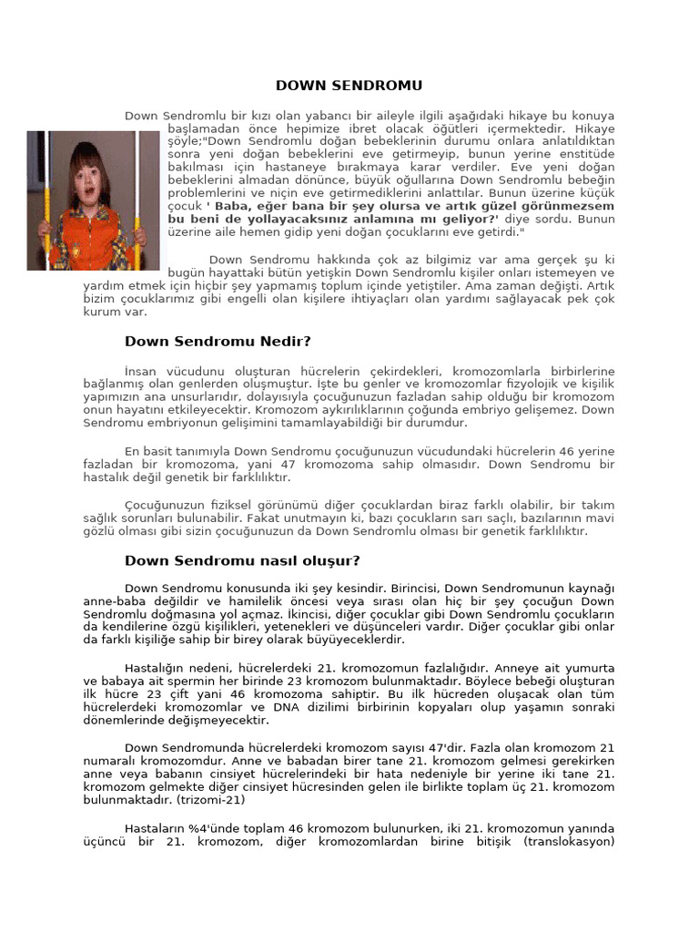 Down Sendromu | PDF