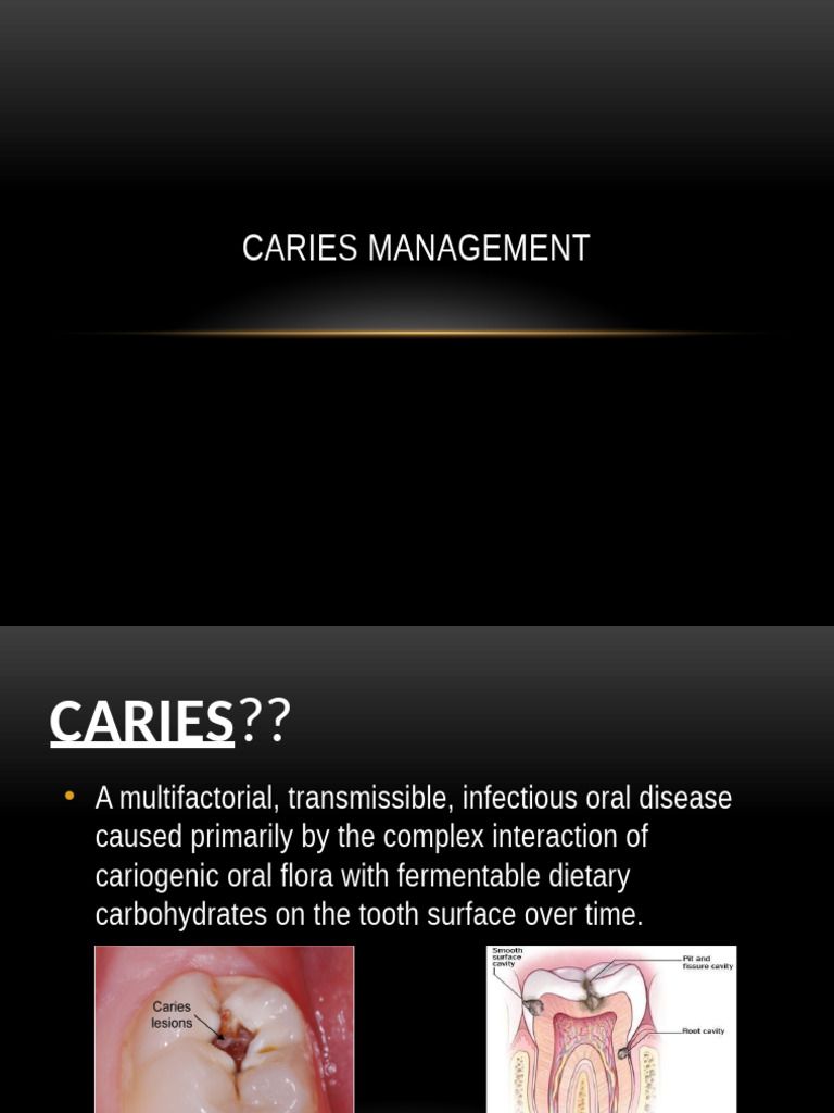 Caries Management | PDF