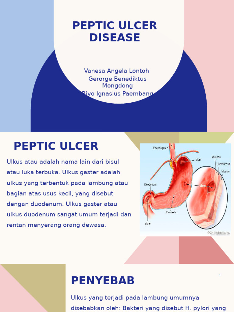 Peptic Ulcer | PDF