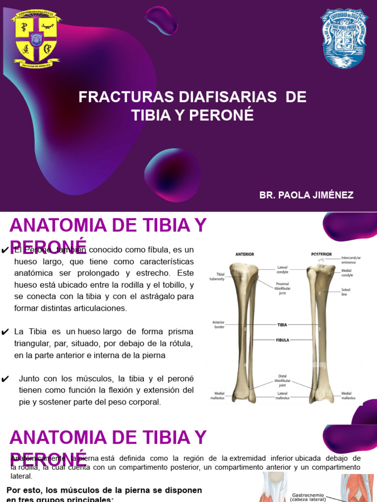 Fx de Tibia, perone y tobillo.pptx | PDF