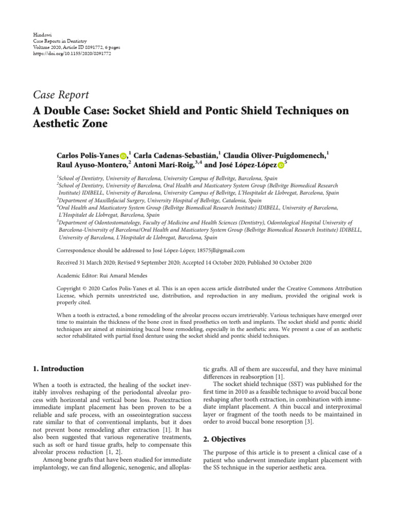 Carlos Polis 2020 - Pontic and Socket Shield | PDF