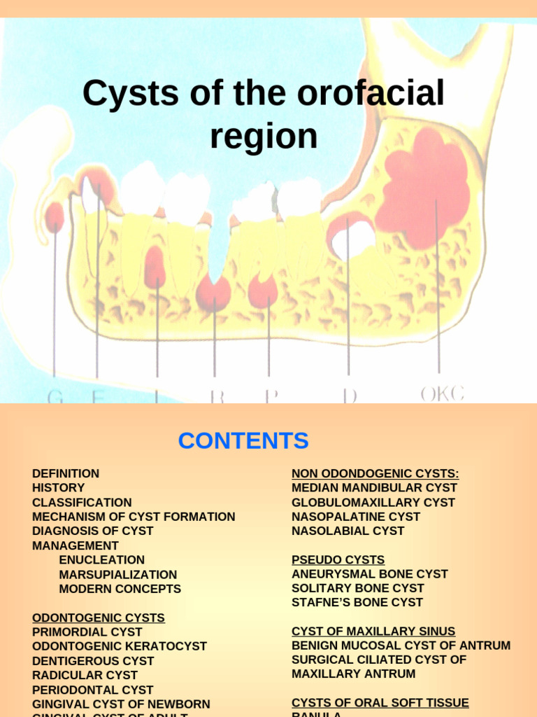 Cysts of Orofacial Region | PDF