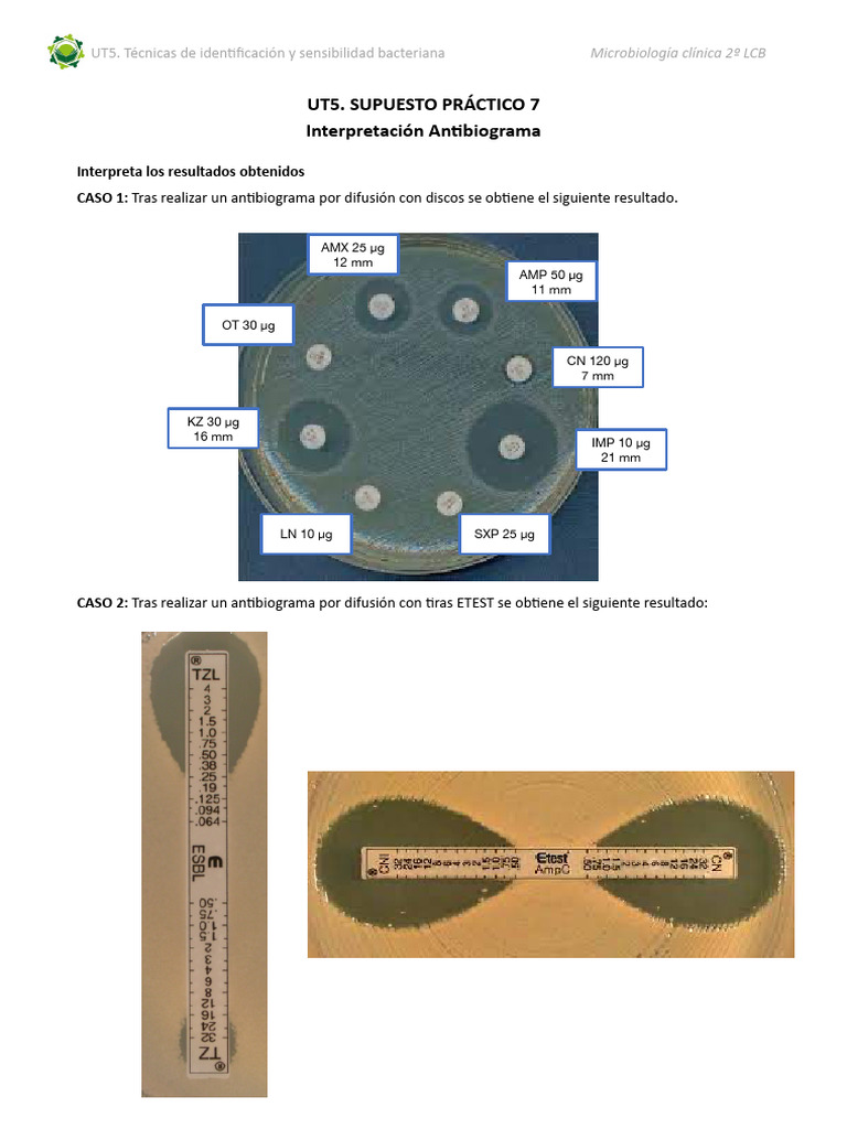 UT5. SP7. Antibiograma | PDF