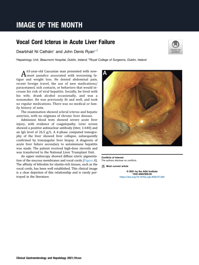 Vocal Cord Icterus in Acute Liver Failure 2020 Yjc | PDF