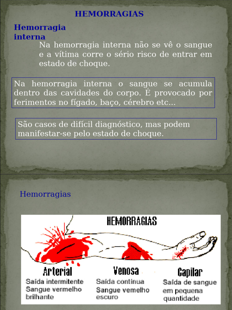 Hemorragias | PDF