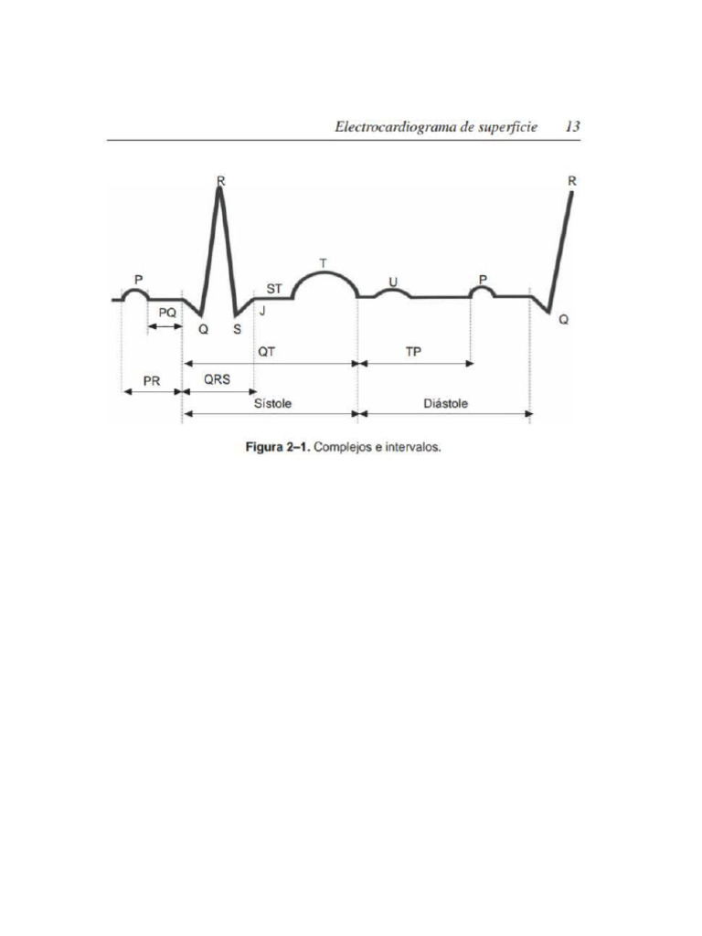 Algoritmo Ekg | PDF