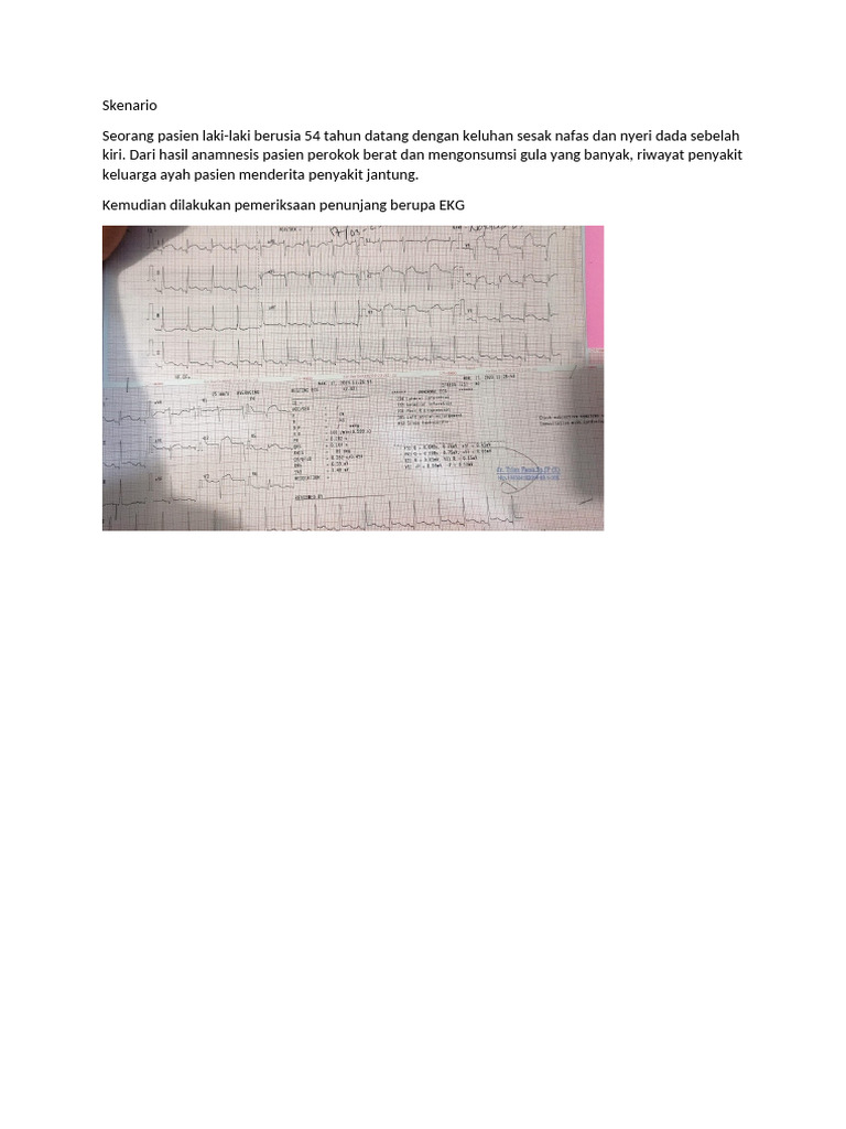 EKG Dari IPass Cardiology | PDF