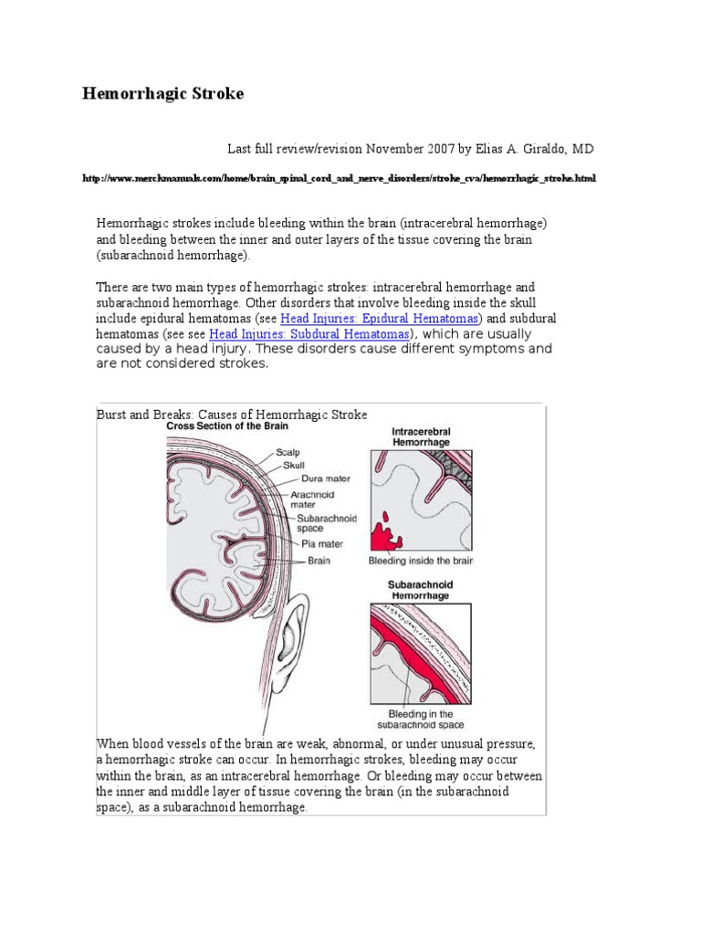 Hemorrhagic Stroke | Stroke | Ischemia