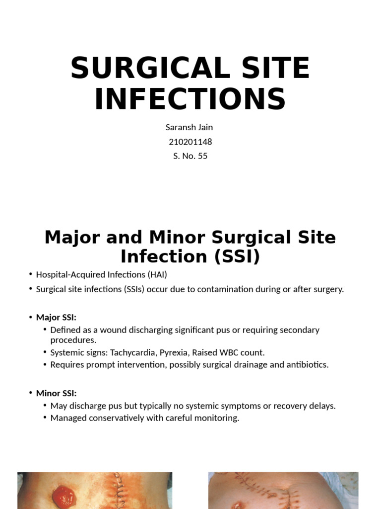 Surgical Site Infections | PDF