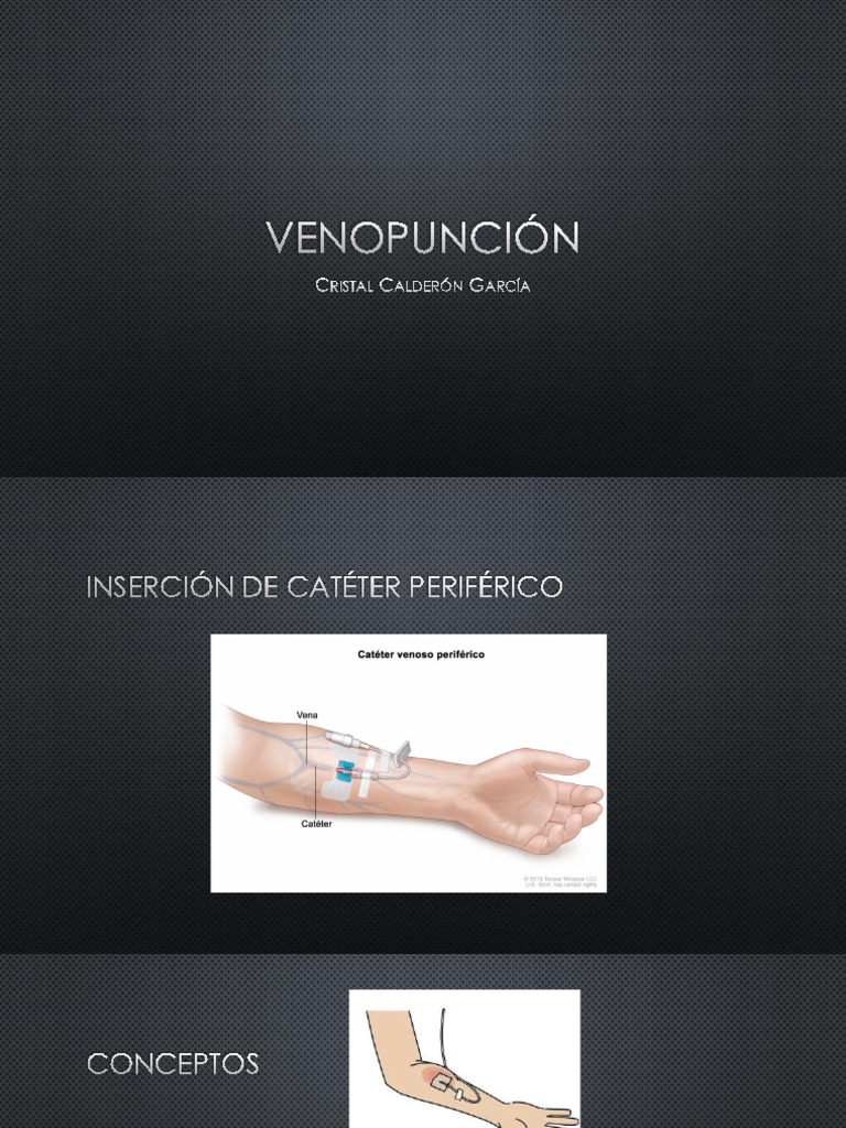 Venopunción: Técnica y Consideraciones | PDF