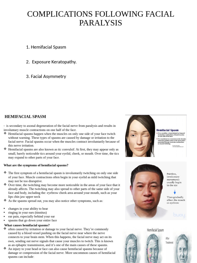 Complications Following Facial Paralysis | PDF