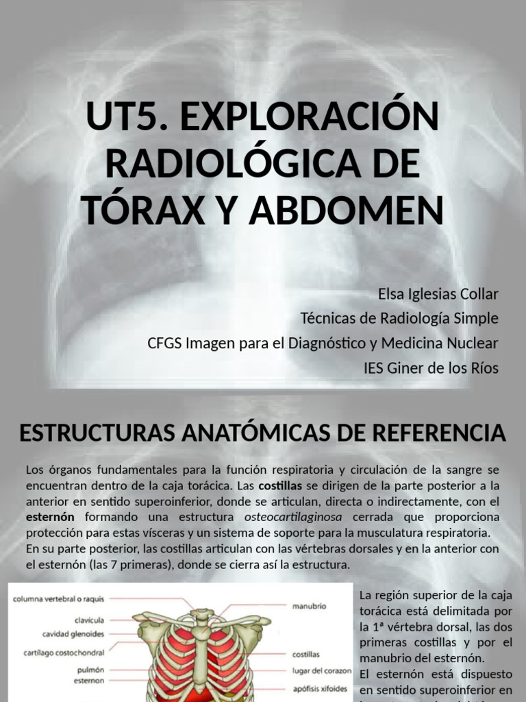 UT5. Tórax y Abdomen | PDF