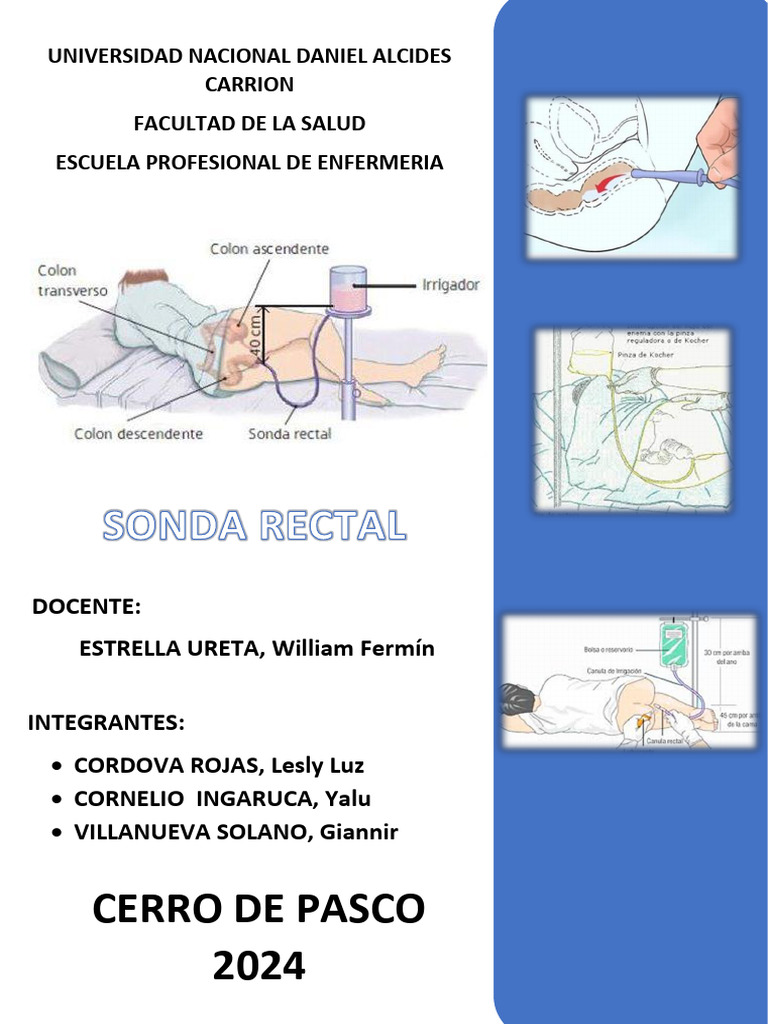 Sonda Rectal | PDF