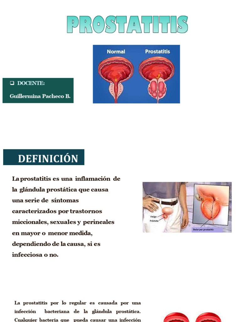 PROSTATITIS | PDF