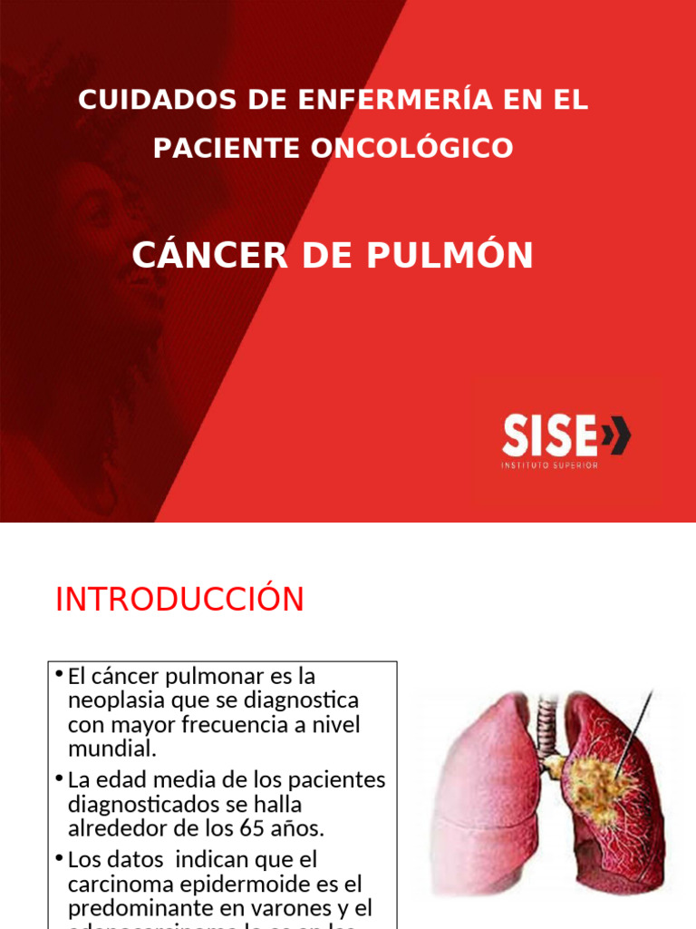 Cáncer de Pulmón: Cuidados de Enfermería en El Paciente Oncológico | PDF