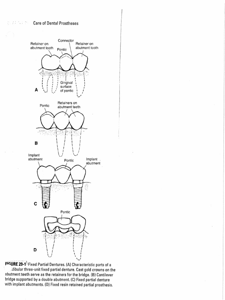 Care For Prostheses | PDF