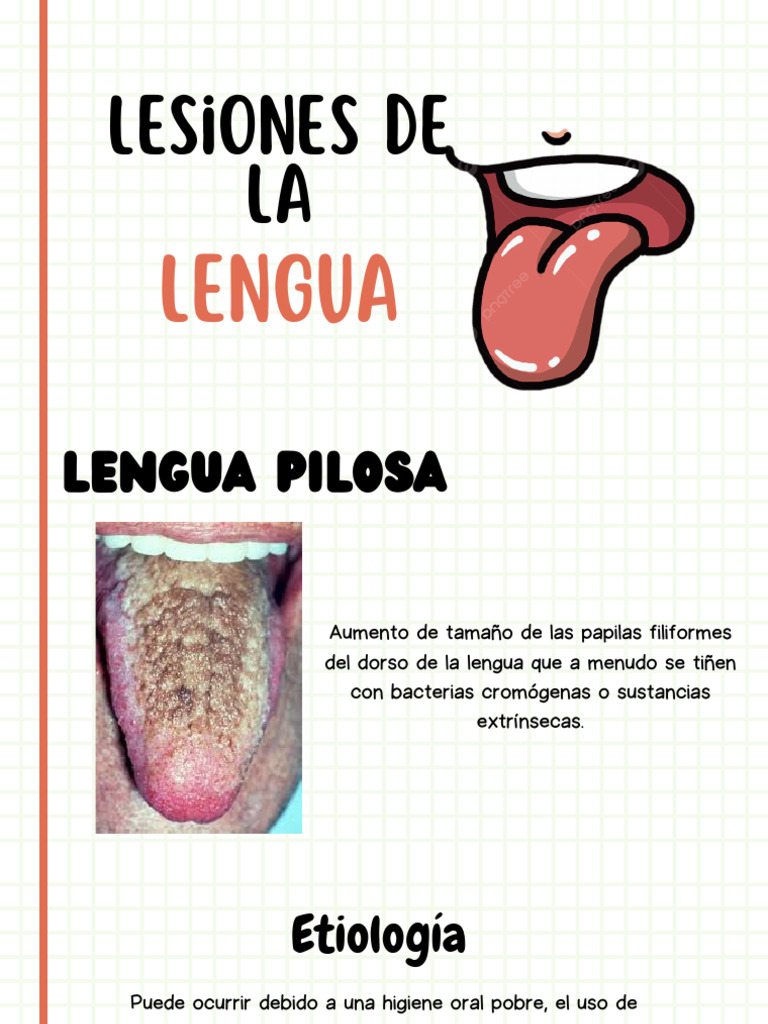 Lengua Pilosa, Fisurada y Osteorradionecrosis | PDF