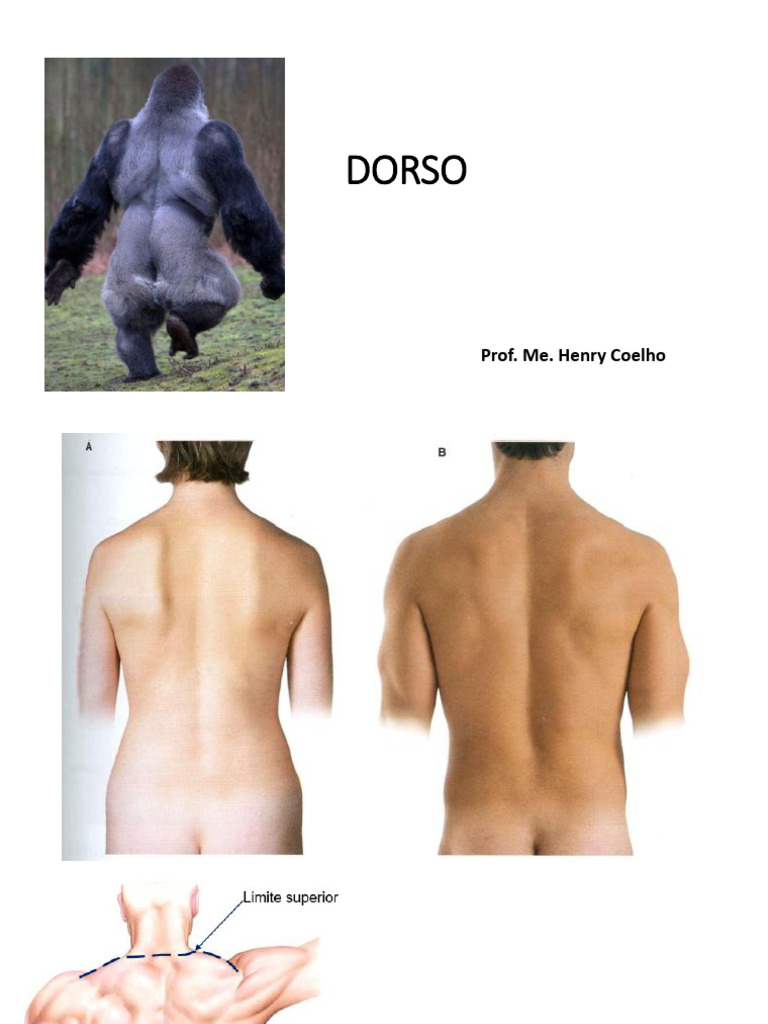 Anatomia Do Dorso - 2024-2 | PDF