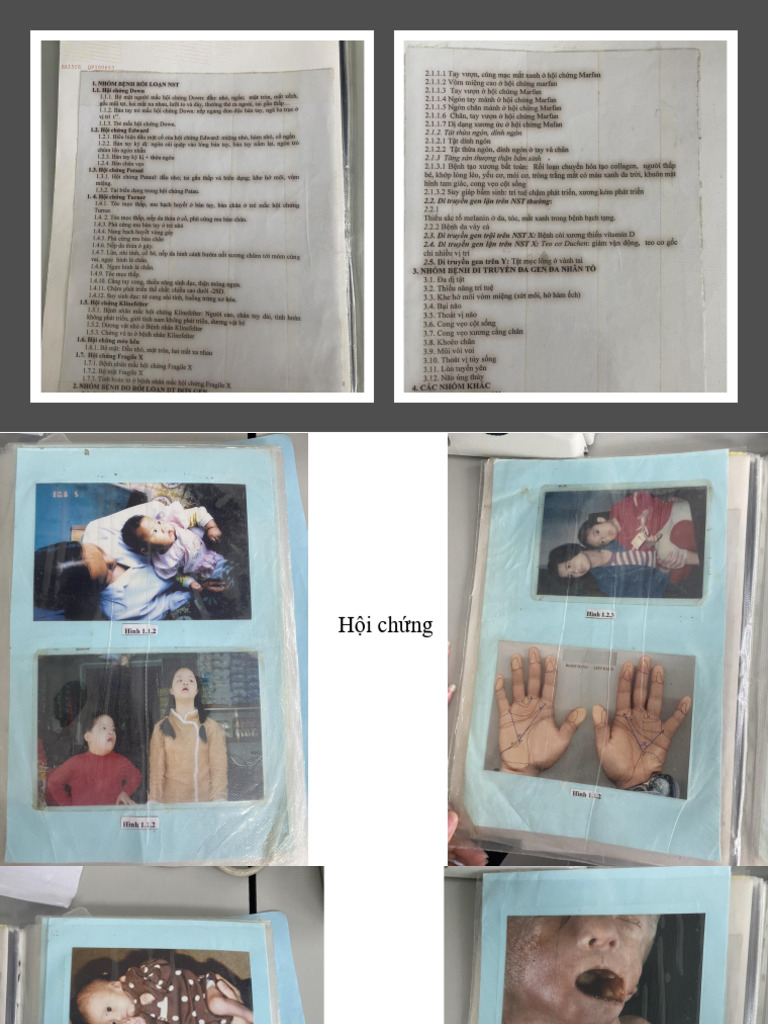 Slide-BỆNH-LS | PDF