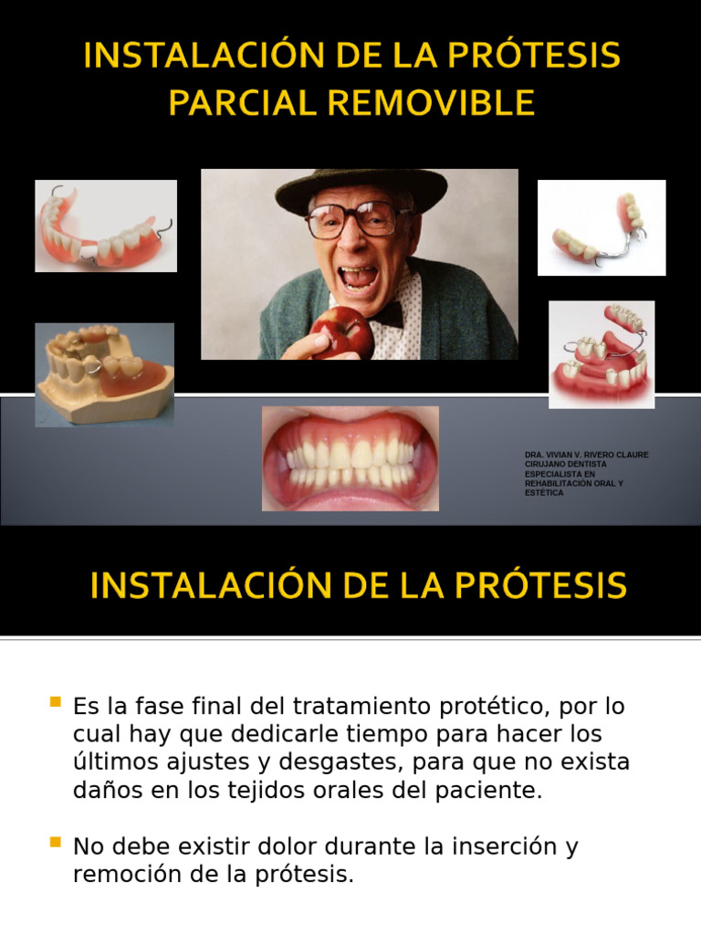 Instalación de La PPR | PDF | Higiene oral | Hogar y jardín