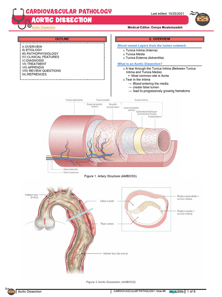 Aortic Dissection Etiology, Pathophysiology, Diagnosis, Clinical ...