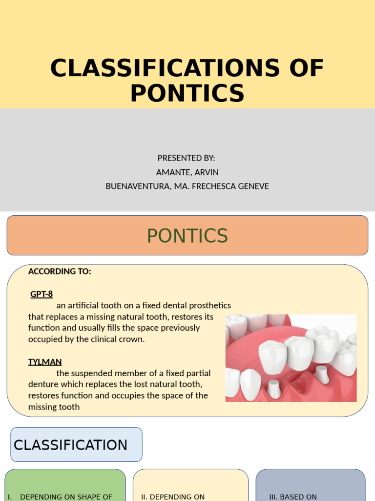 Classification of Pontics | PDF
